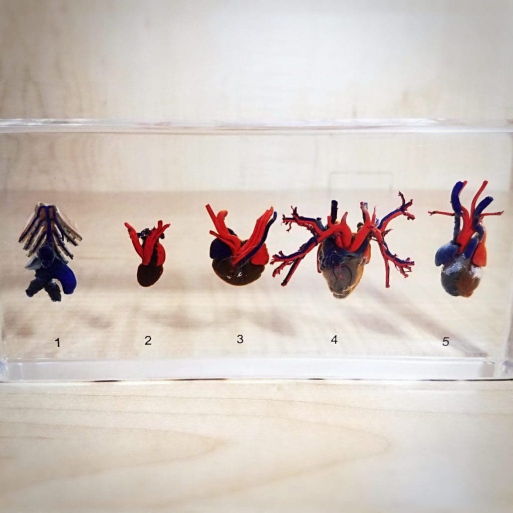 Real Hearts, Comparative Hearts in Resin, Oddities, Curiosities ...