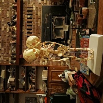 2 Headed Fetal Skeleton, Human Fetus Skeleton, Conjoined Twins Skeleton ...